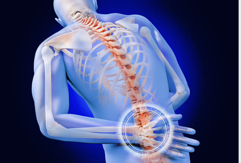 What Can Cause a Collapsed Disc | BEST