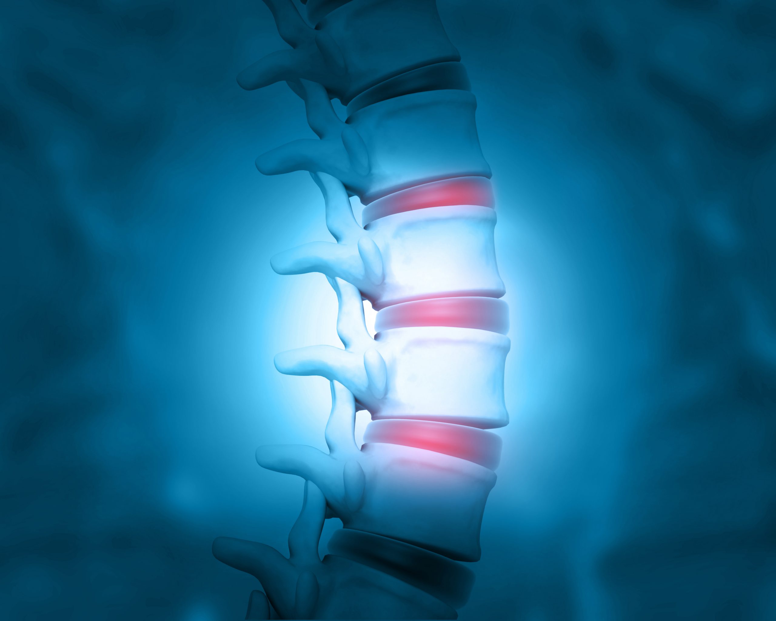 Bulging Disc - Three Alternative Treatment Options | BEST Health System