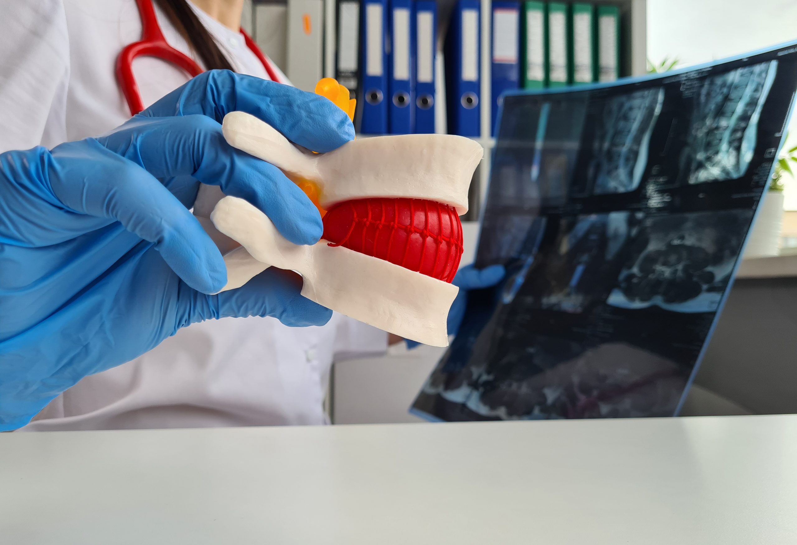 Where Is An Intervertebral Disc Located | BEST Health System